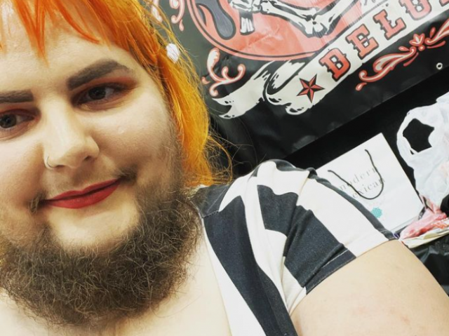 Žena sa BRKOVIMA I BRADOM: Brijala se dva puta DNEVNO, a sada je ...